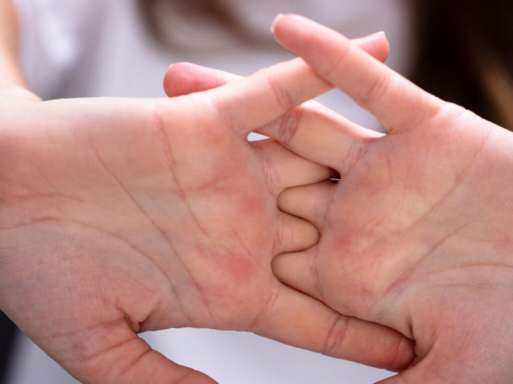 ¿Tronarse los dedos? ¡No hagas eso! | Tips de Salud