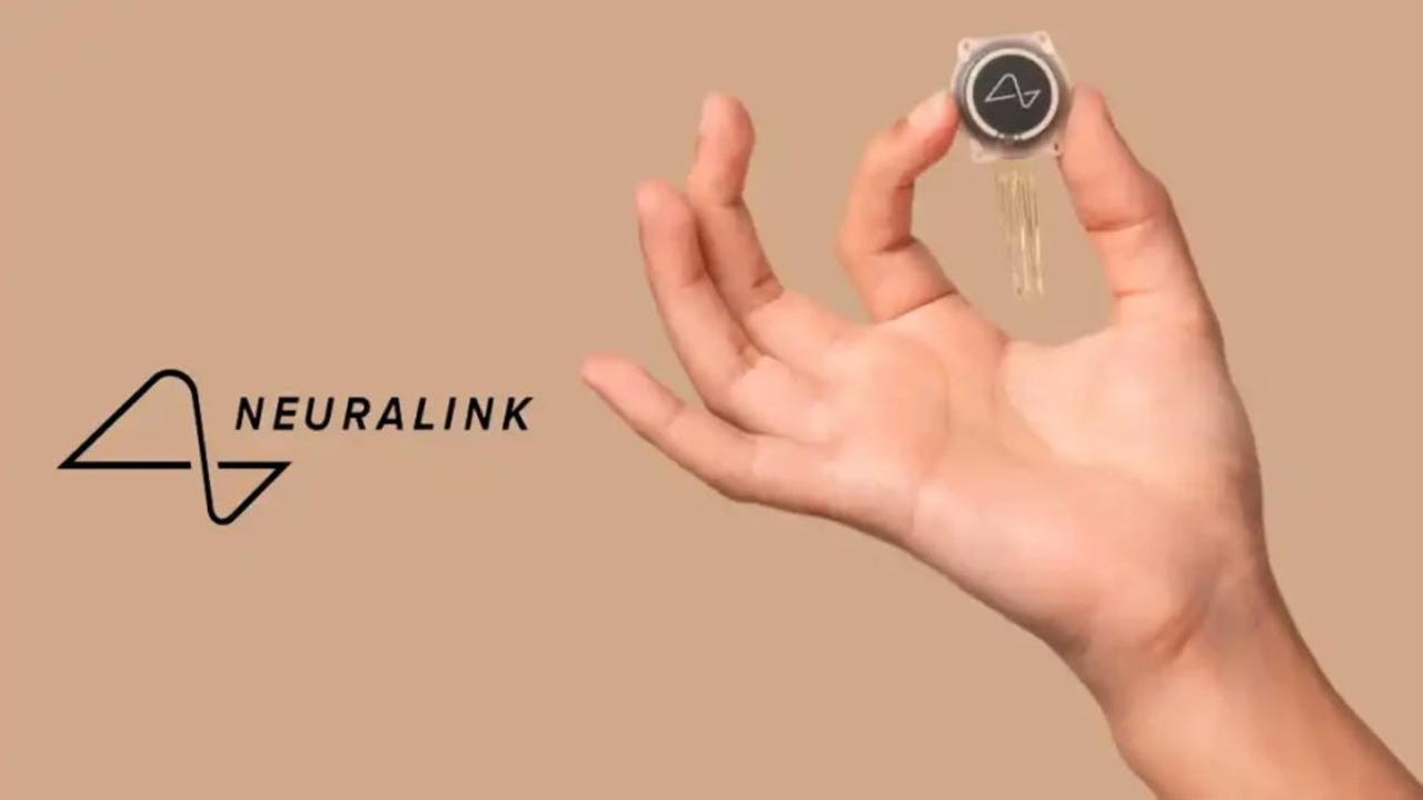 2026 podría ser el año clave de Neuralink: ¿por qué? | Tecnología